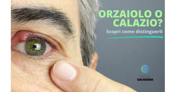Calazio o orzaiolo? Come distinguerli.
